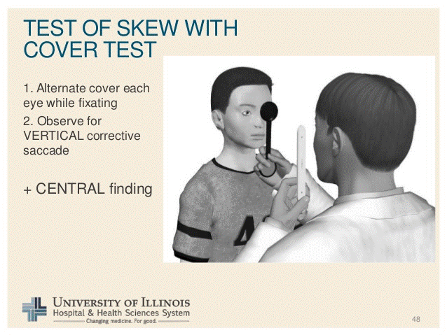 FIGURAS DE LA CLASE COMPL. DE SINDR. VESTIBULARES - VIDEONISTAGMOGRAFÍA ...